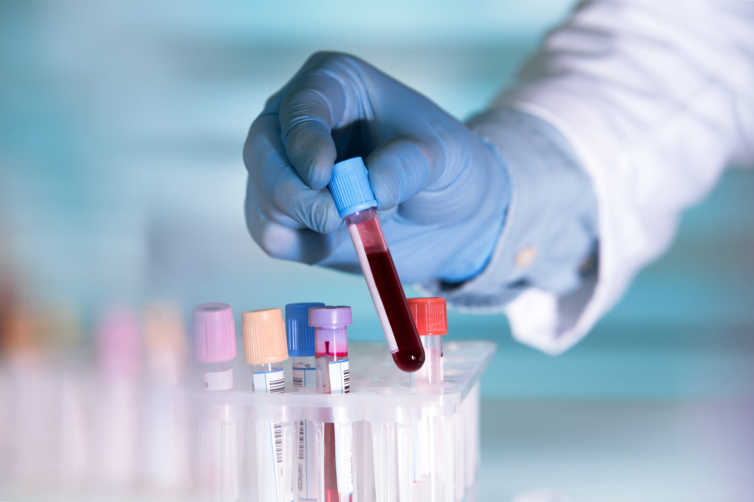 Lab Tests | Whole Life Clinic PMA